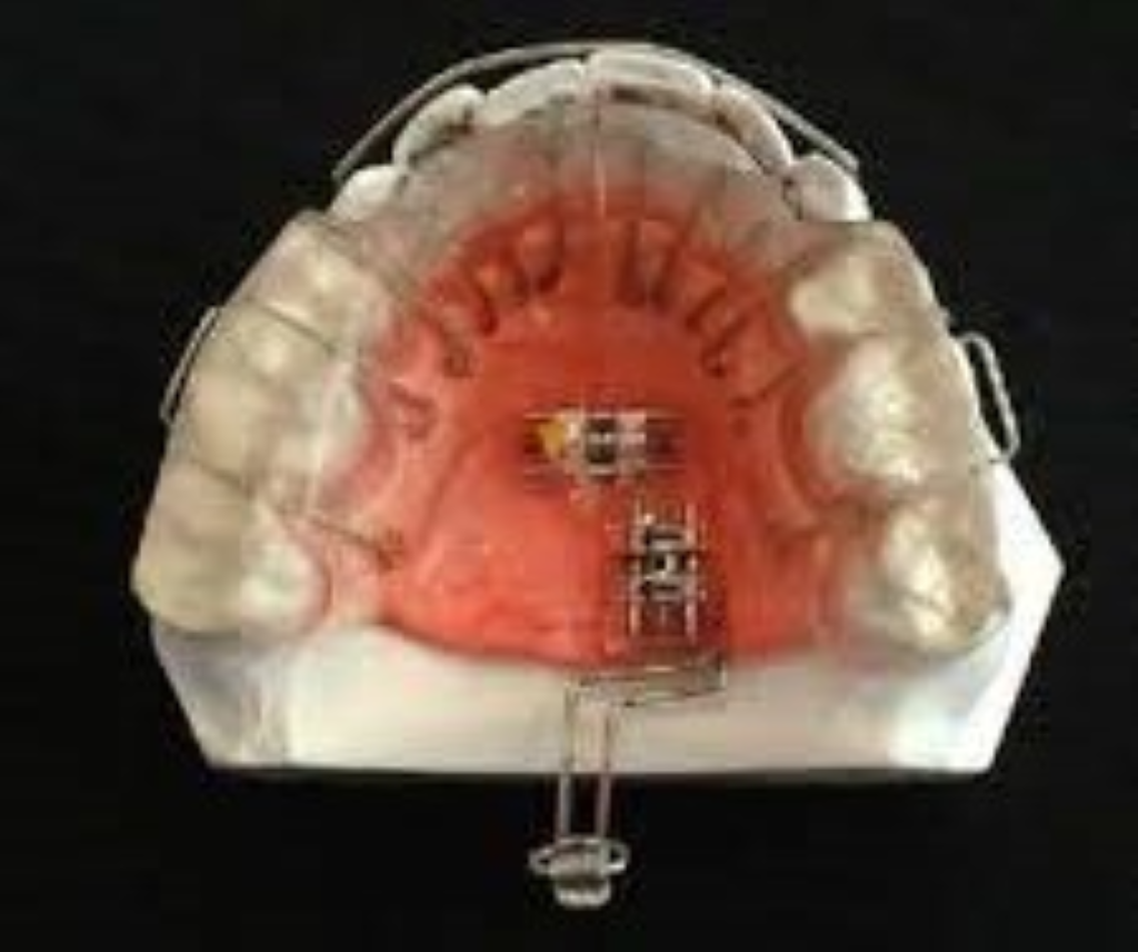 Dental Sleep Solutions & Services | Nevada Dental Sleep